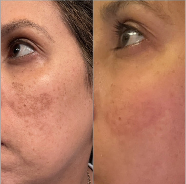 Musely Prescription Skin Care Products | Dark Spots, Aging, Rosacea ...